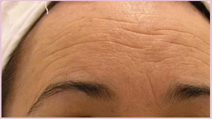 Revert time - NEST Skin, Body & Wellbeing | Beauty Salon Taringa Call ...